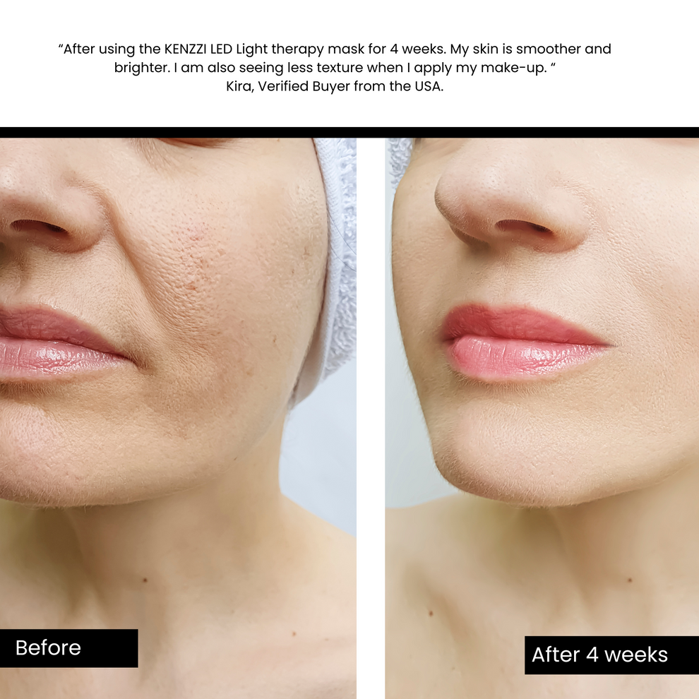 KENZZI LED Light Therapy Mask – Kenzzi