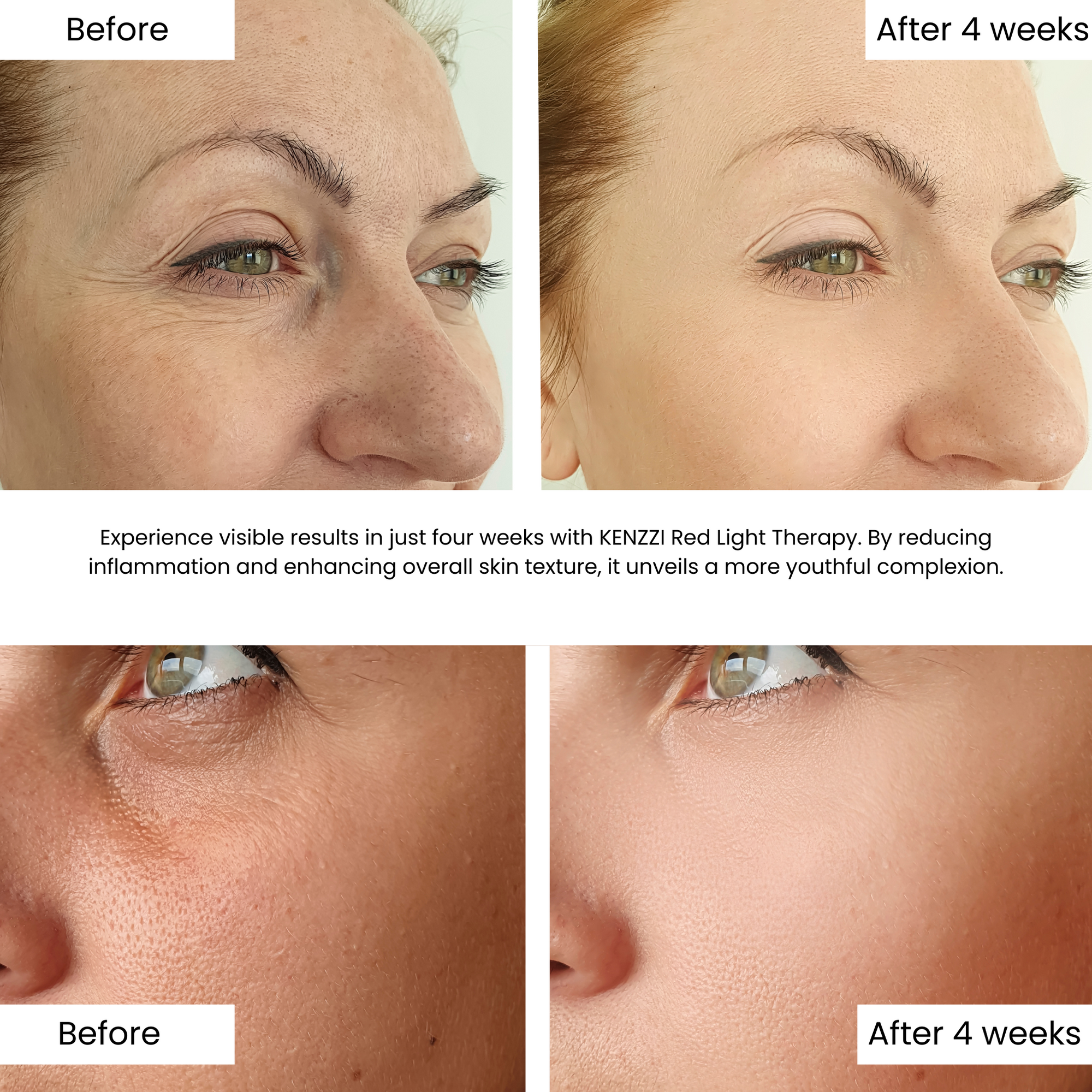 KENZZI LED Light Therapy Mask – Kenzzi