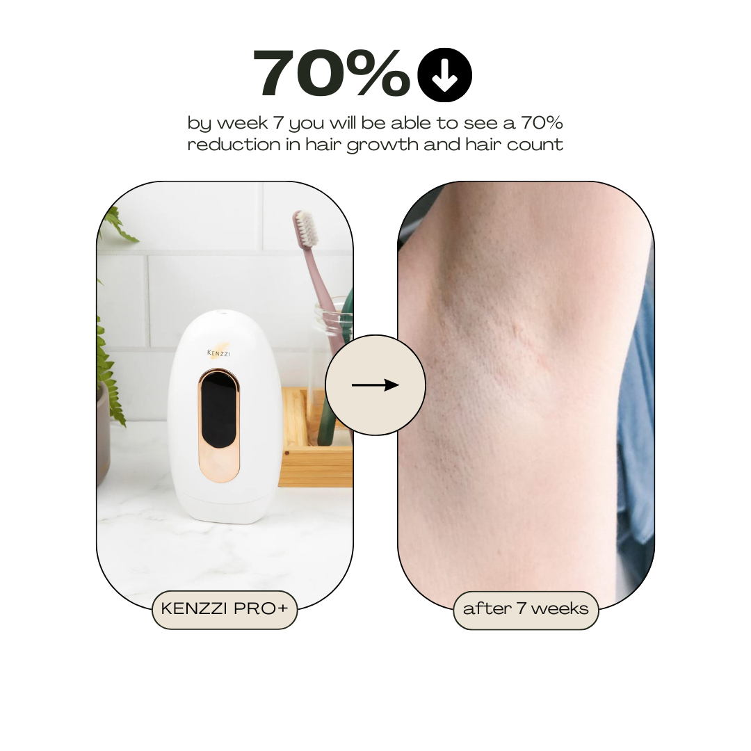 Laser Hair Removal at Home | Kenzzi
